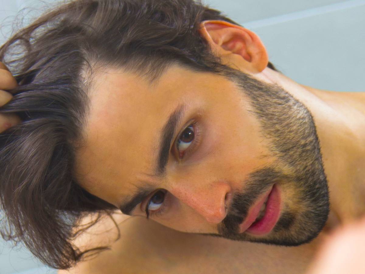 Rigenerazione dei Capelli, la Calvizie si cura senza chirurgia - il ...