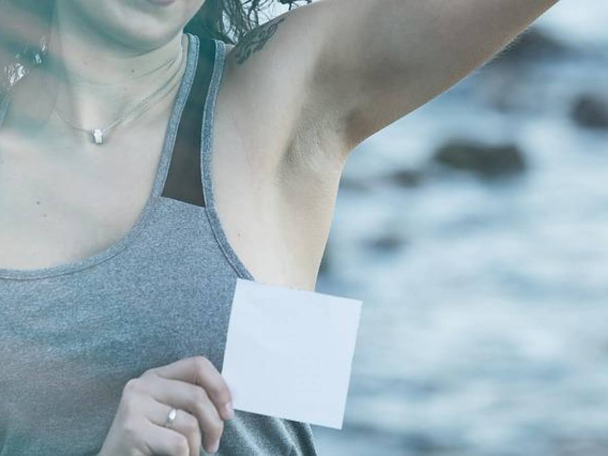 Idrosadenite suppurativa, cause e sintomi dell'acne inversa - il Giornale