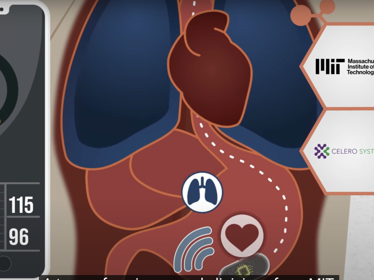 Pillola "smart" per monitorare i segnali vitali: come funziona - il ...