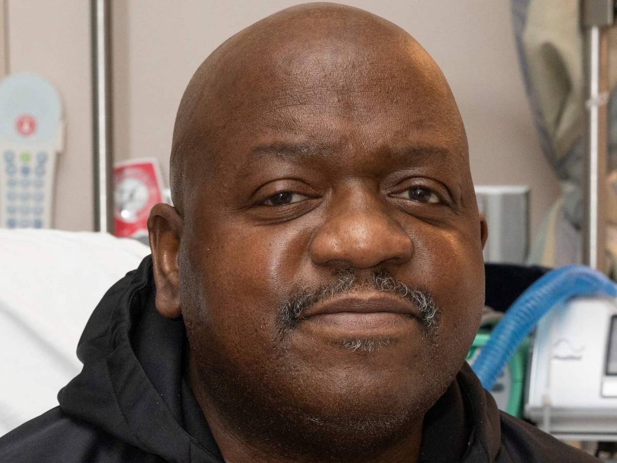 Ebbe un rene di maiale: morto dopo 2 mesi - il Giornale