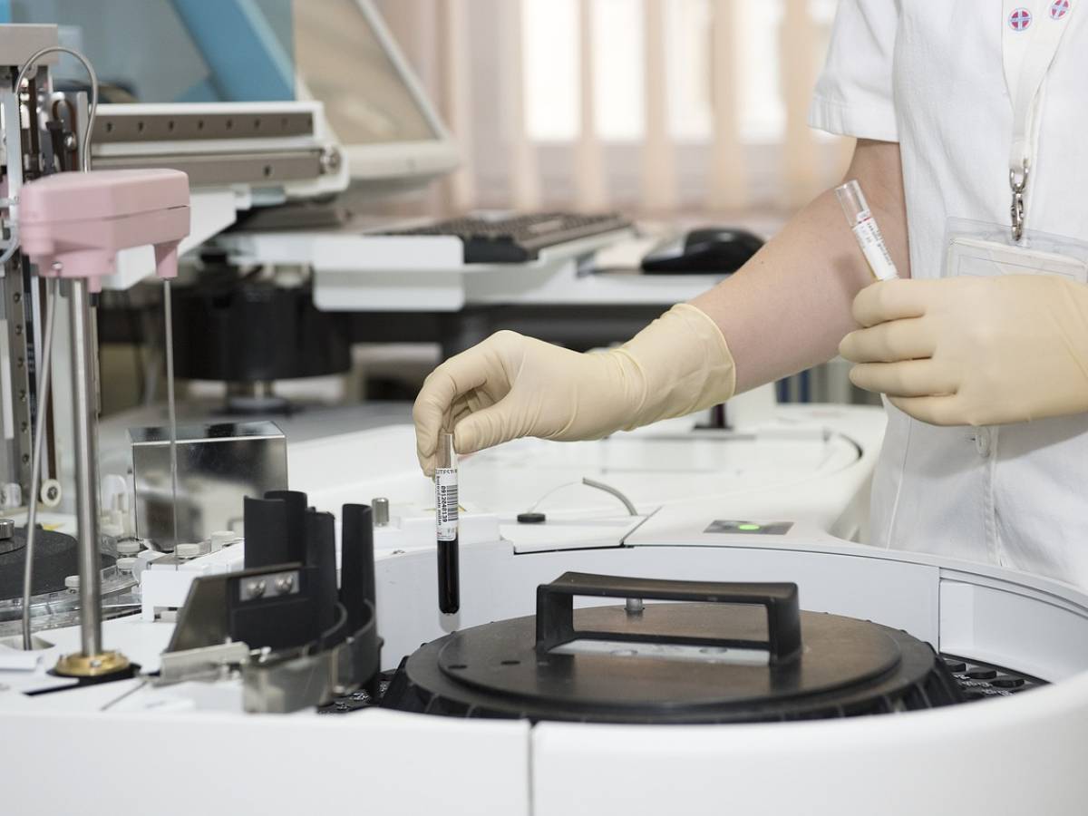 Scovare un tumore al pancreas? Basterà un test del sangue Scovare un tumore al pancreas? Basterà un test del sangue