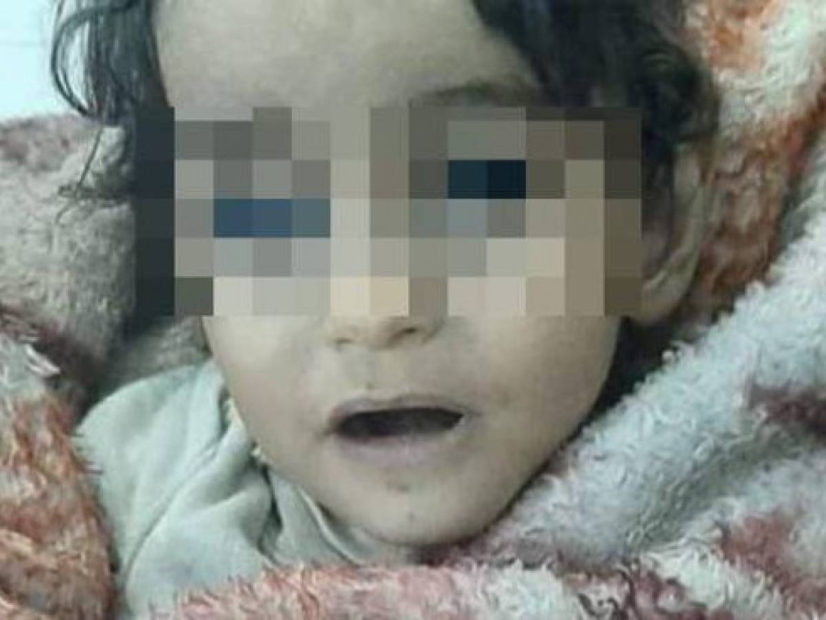 Siria, la piccola Imam come Aylan - il Giornale